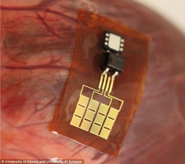 Human Implantable Battery Uses Heart Beats To Charge Itself
