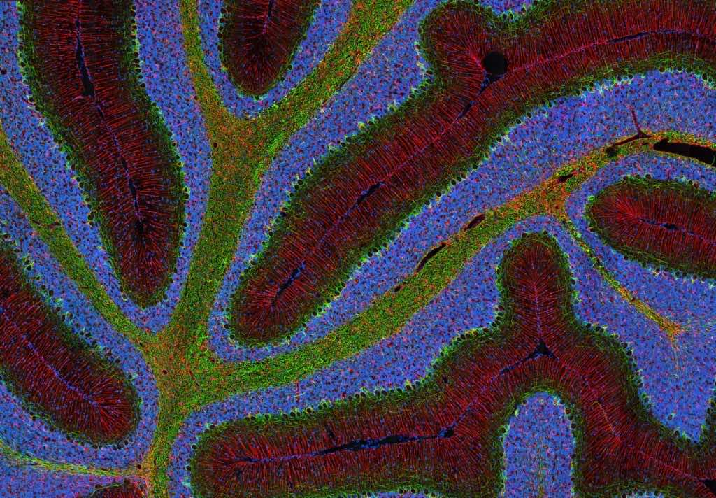 These HD Microscopic Photos Show Us Another World Of Existen