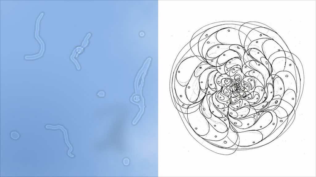 Ever Wondered What Are Those Floating Objects In Your Eyes?