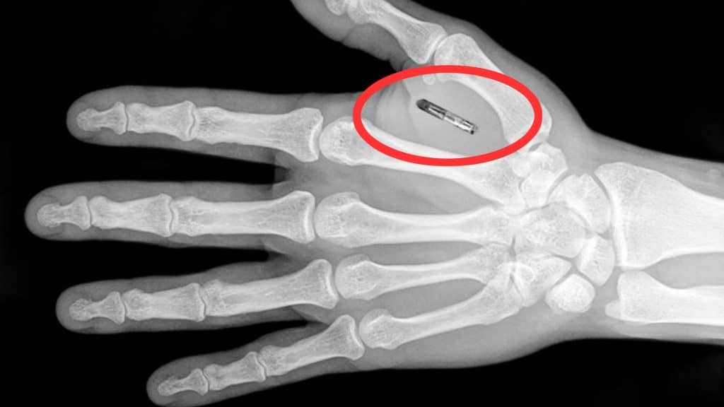 This Swedish Tech Company Implants Microchips In Their Emplo