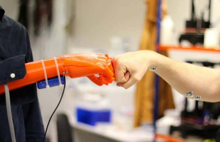 World's First Trial For 3D Printed Bionic Hands For Children