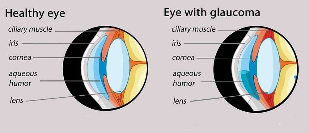 This Is The Most Dangerous Thing You Can Do To Your Eyes