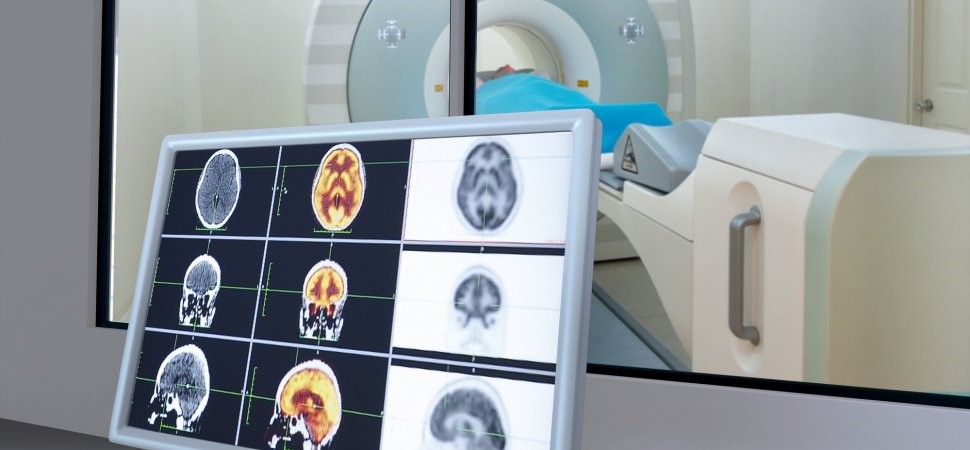 AI Can Now Help Doctors In Early Detection Of Cancer