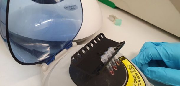 NEW SAMBA II MACHINE CAN DIAGNOSE COVID-19 PATIENTS IN 90 MINUTES