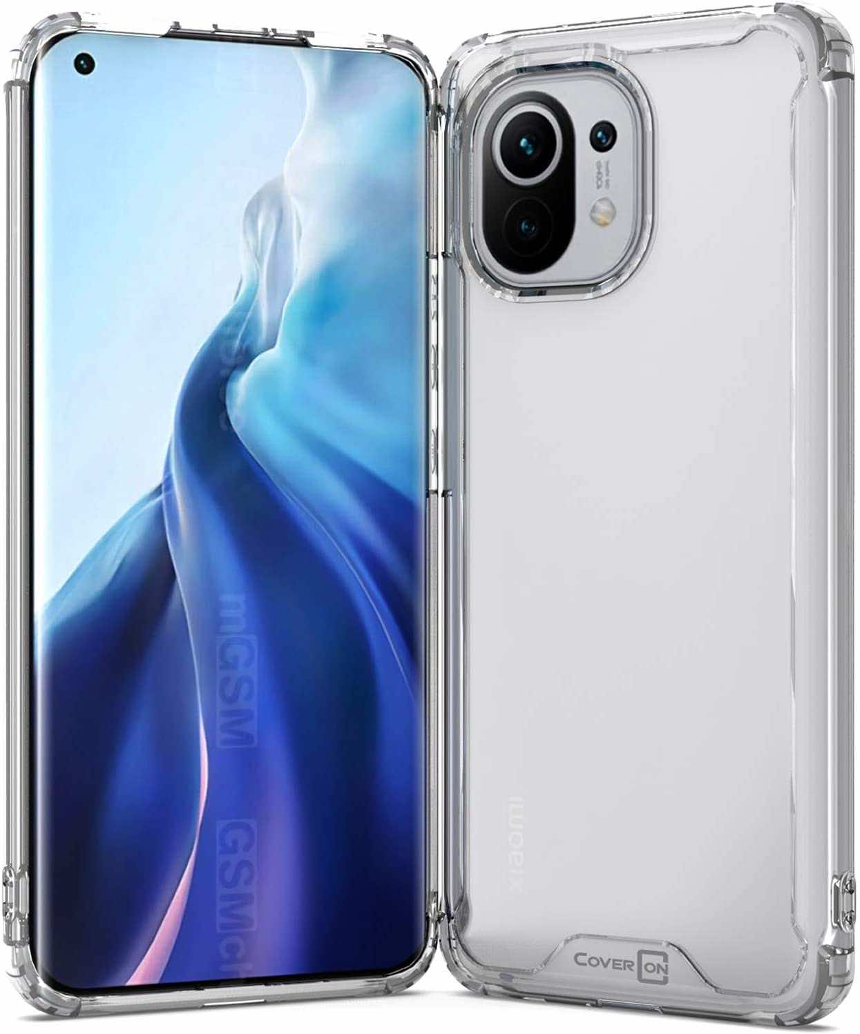 10 Best Cases For Xiaomi Mi 11