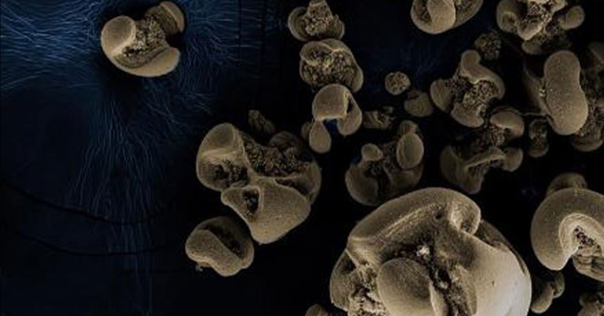 These New Metal-Eating Bacteria Can Consume A Nail In Just 3