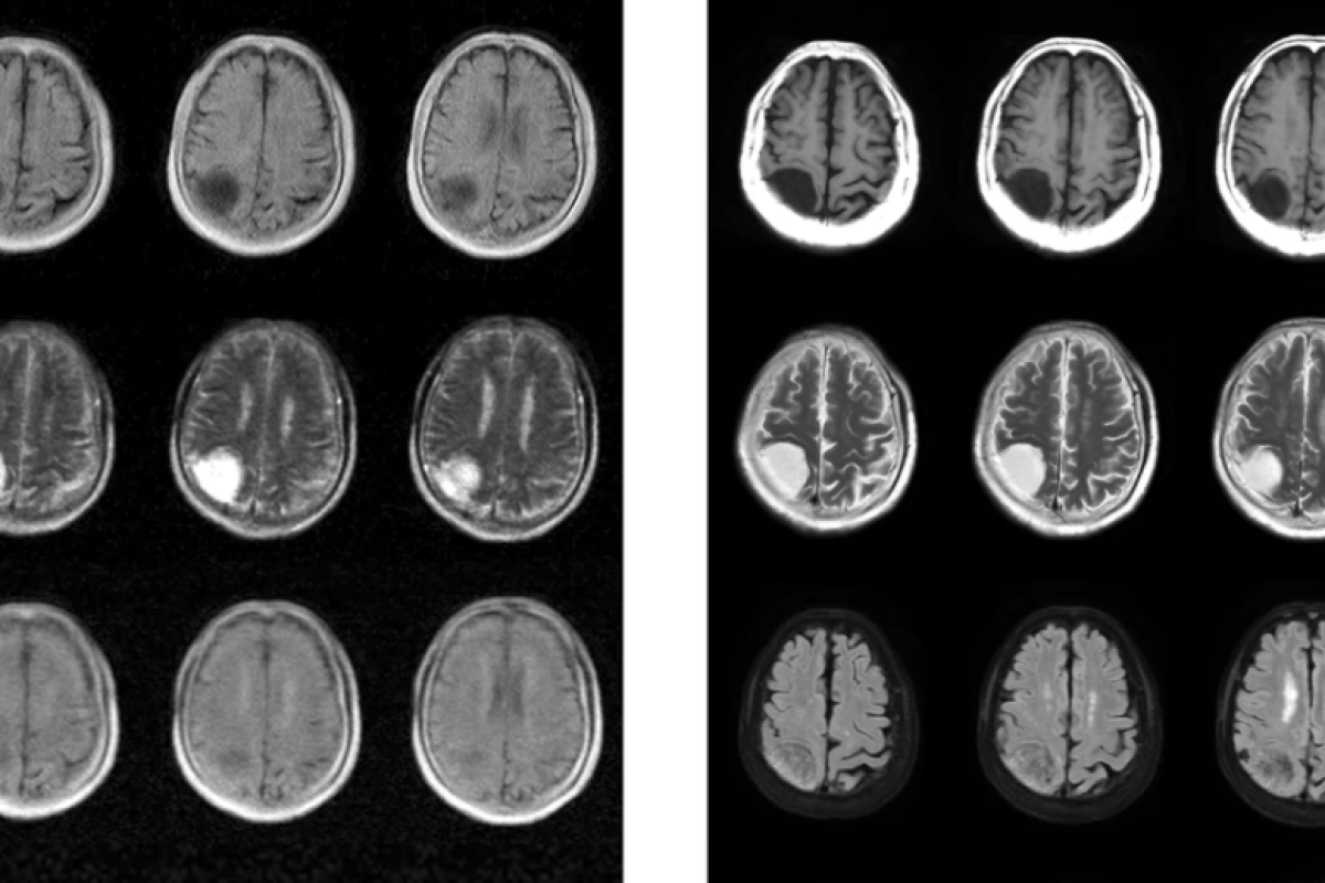 This New Mobile MRI Machine Can Perform Brain Scans At A Fra