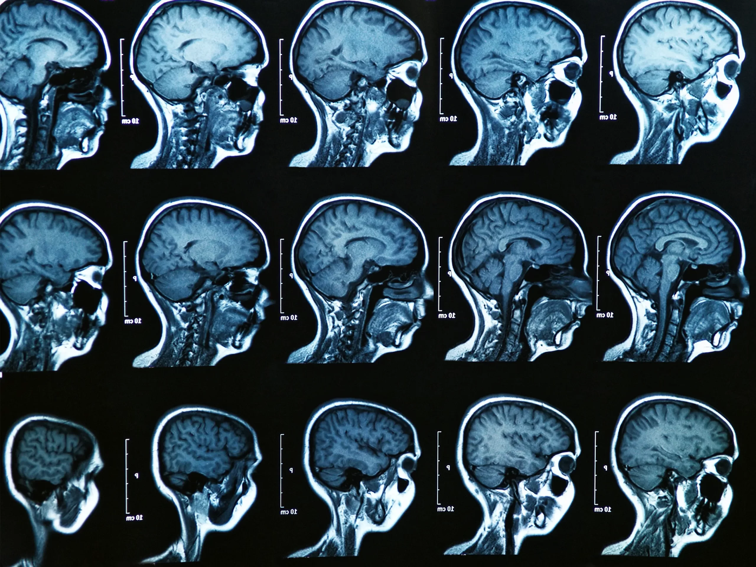 Brain Imaging Just Got 64 Million Times Sharper Thanks To Th
