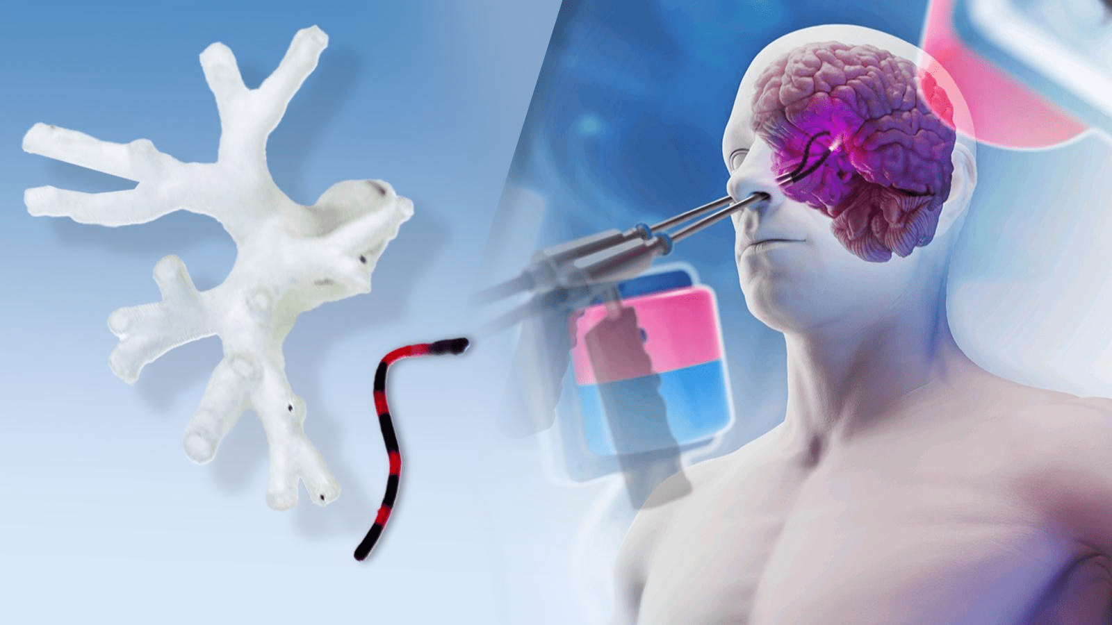 This New Surgical Robot Can Travel Deep Into The Lungs And I